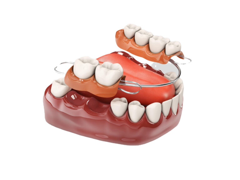 What Are The Realest Looking Dentures?